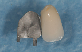 Dental Treatment Results | Cosmetic Dentist Henley